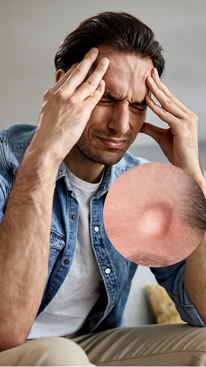 टेंगुळ का येते? त्यावर उपाय काय..