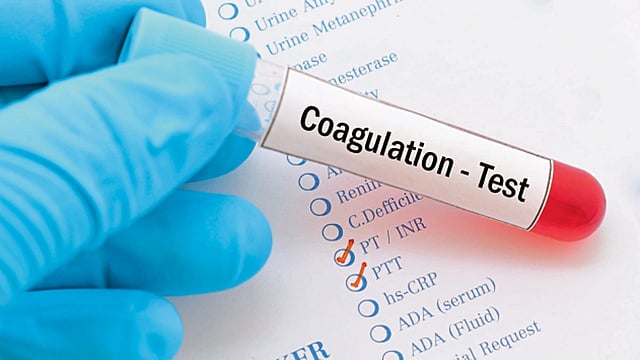 रक्ताची गुठळी होण्याची क्षमता Coagulation Test Blood clotting ability ...
