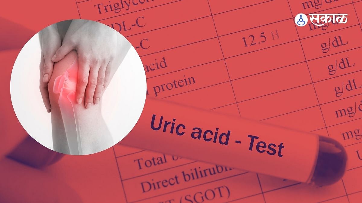 Urik Acid Control: हिवाळ्यात यूरिक अ‍ॅसिडचे प्रमाण राहील नियंत्रणात ...