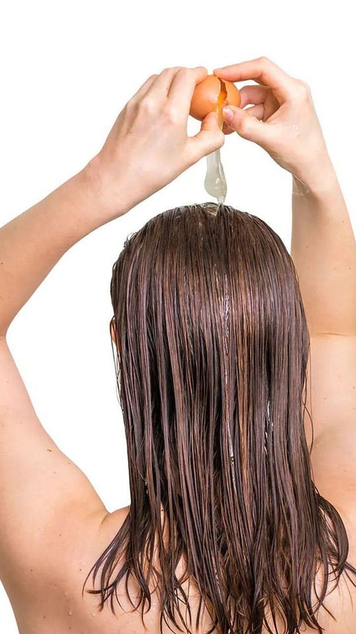 How Eggs Can Help You Prevent Hair Fall and Boost Hair Growth Naturally ...