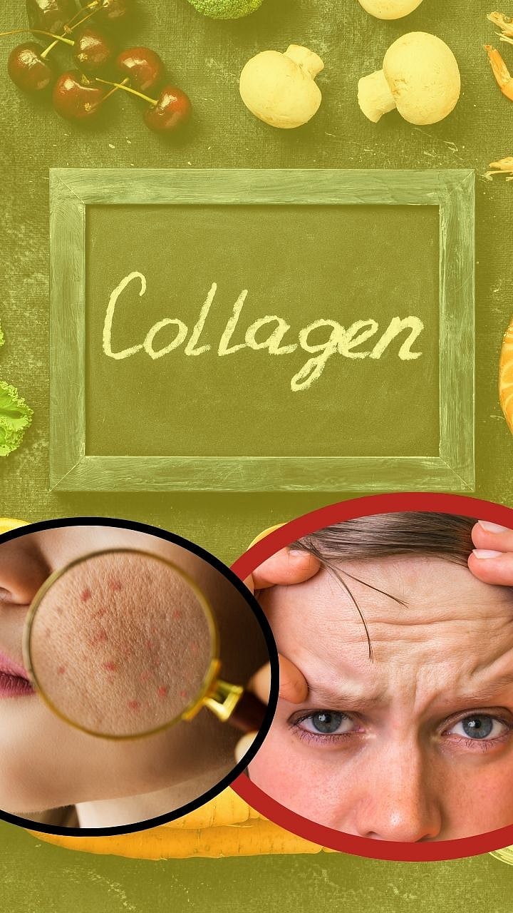 Boost Collagen Naturally: Best Foods for Healthy and Glowing Skin| 'हे ...