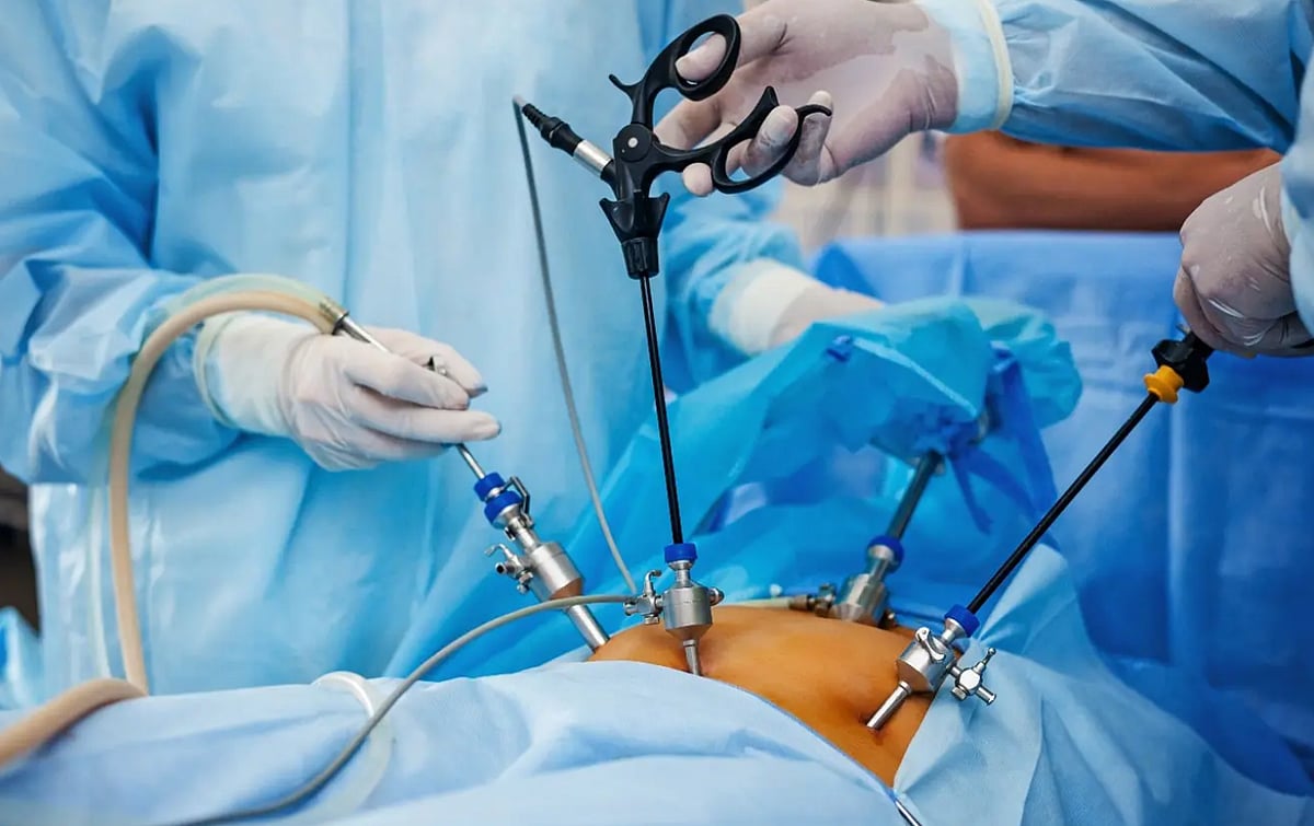 Minimally Invasive Surgery