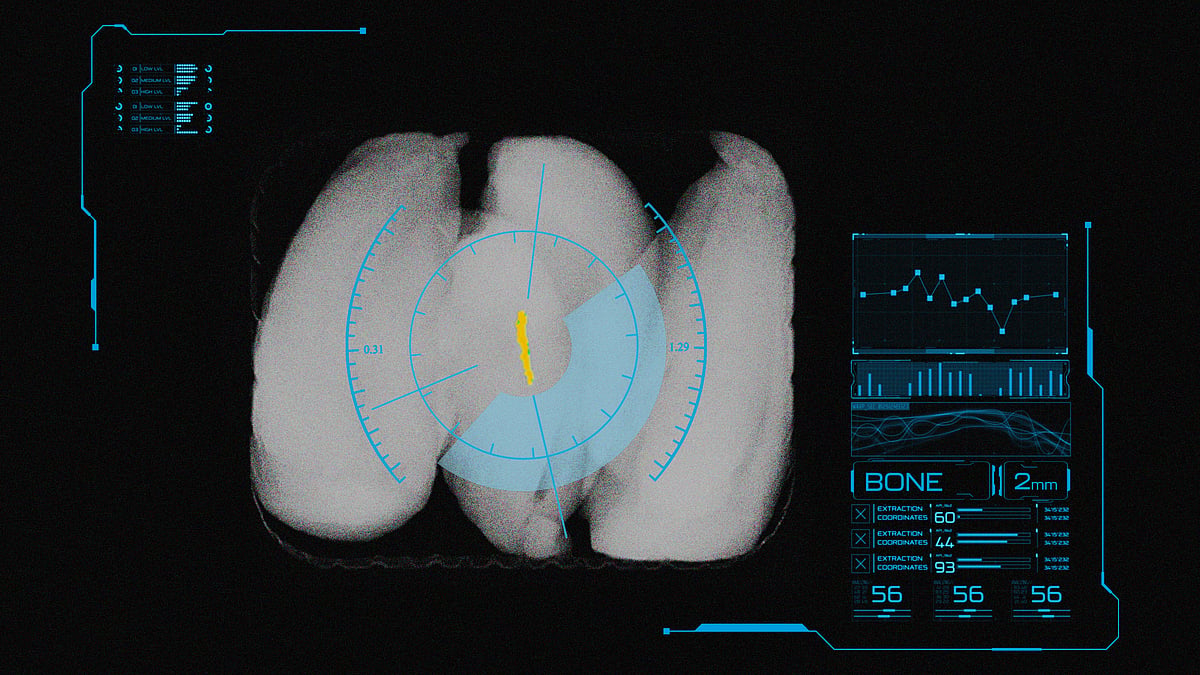 Improve contaminant detection and food safety with Dual Energy X-ray