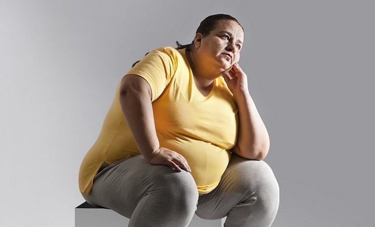 PCOS more prevalent with rise in adolescent obesity