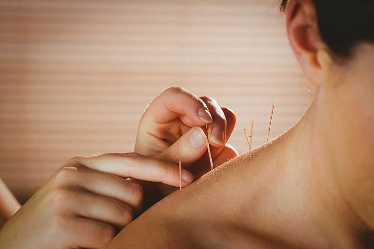 Can acupuncture restore thyroid balance in the body?