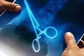 Scissors left in abdomen after caesarean: Consumer Forum awards Rs 6.5 ...