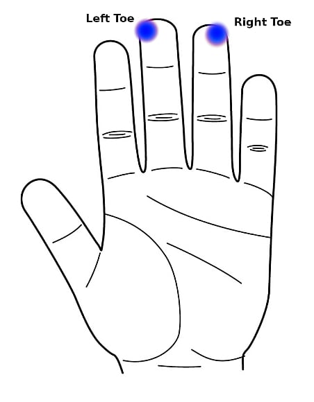 Sujok Therapy for managing gout pain