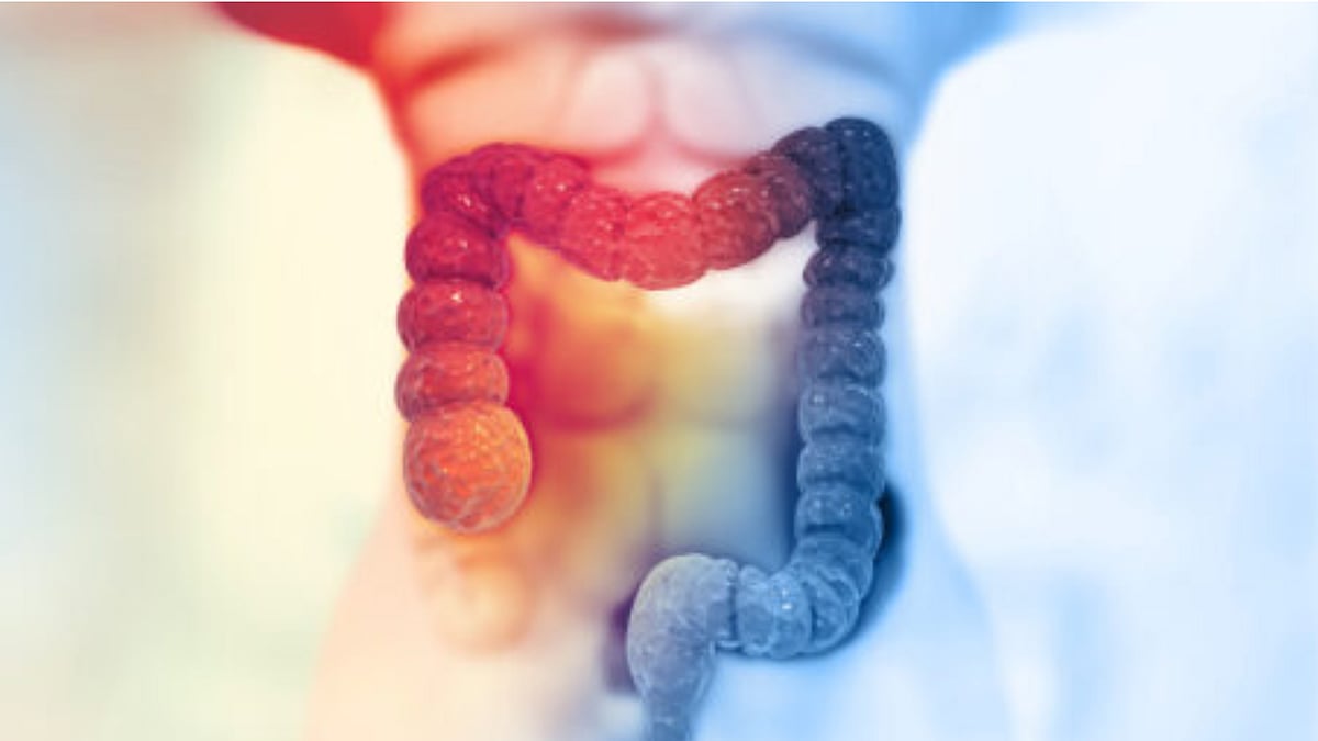 Can people with a family history of colorectal cancer reduce their own ...