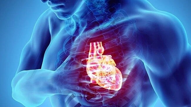 What are the key difference between the Heart attack and Heart failure?