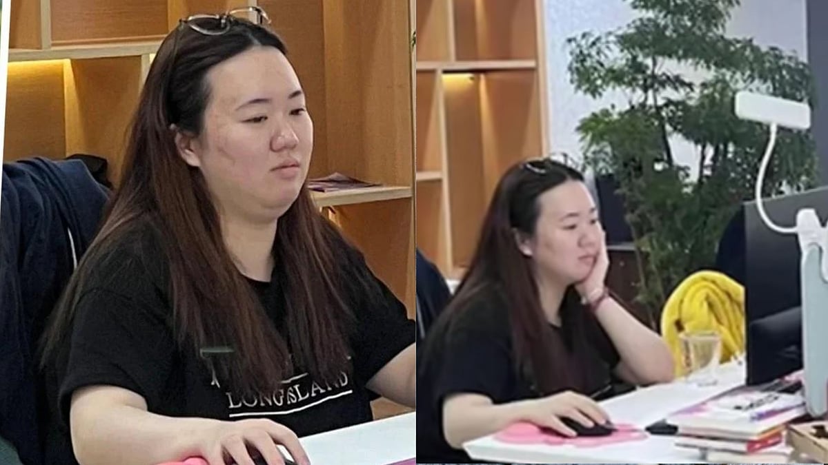 Chinese Woman Gained 20 Kgs In One Year Due To '996' Work Culture; Know ...