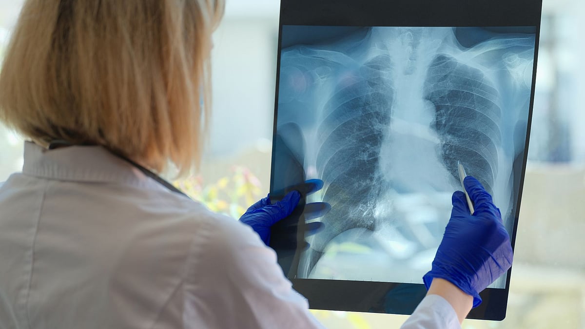 World Lung Day: Infections Can Be Avoided With Voluntary Vaccination ...