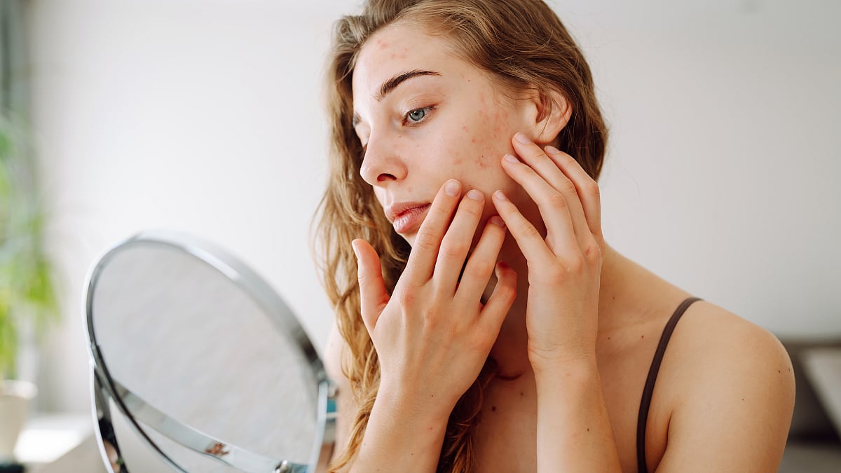 Struggling With Winter Dryness? Here's How To Keep Your Hair And Skin ...