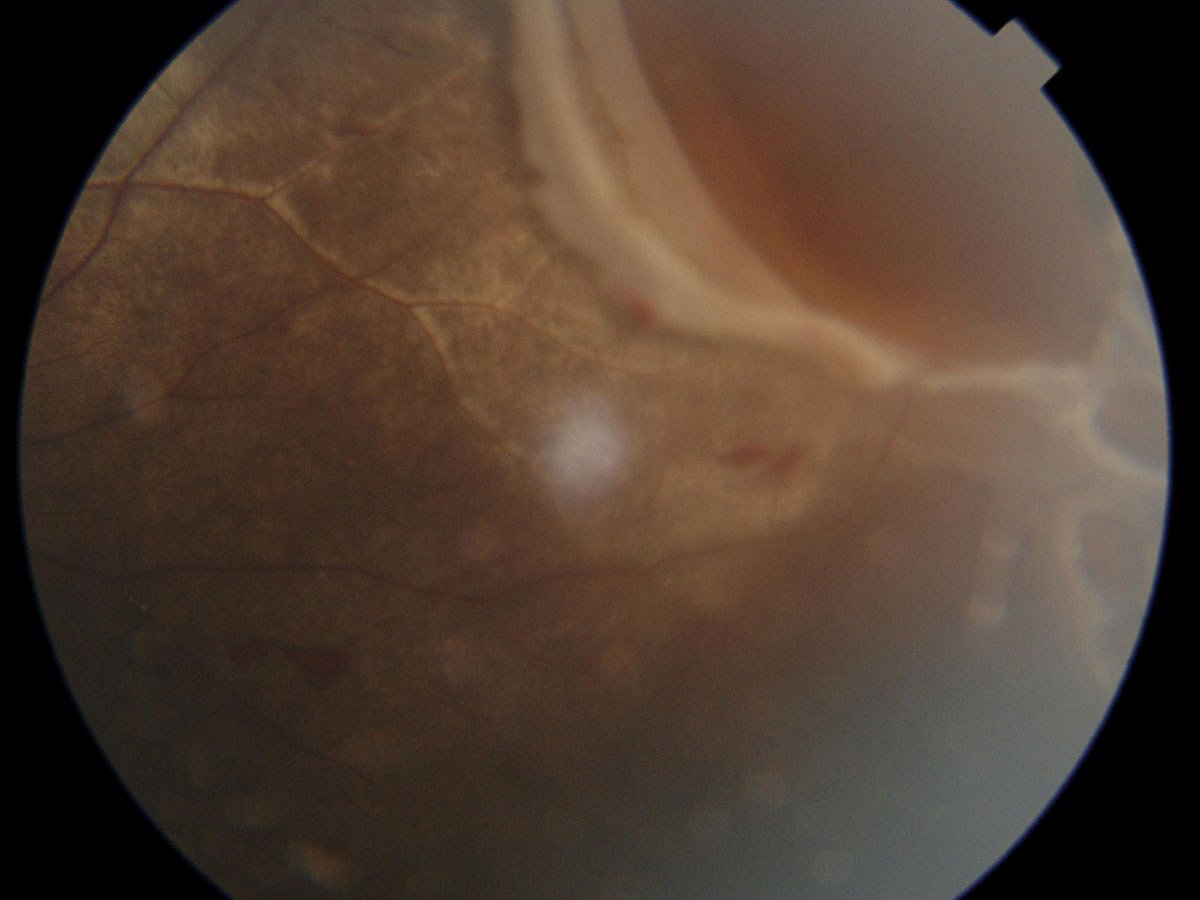 Boy suffers freak injury after cricket ball hits eye; Dubai doctors ...