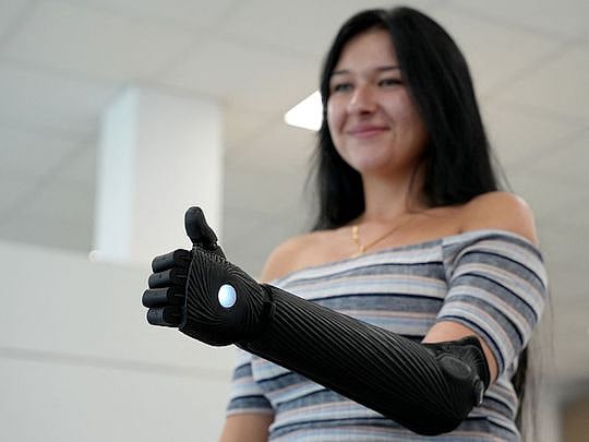 Photos: Limbless woman gets 3D-printed bionic arm