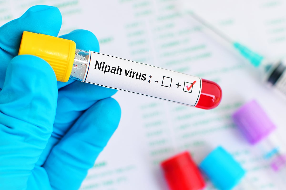Nipah Virus Outbreak in India: Airports Implement COVID-Style Screenings