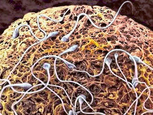 Sperm drop ‘could make humans extinct’