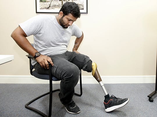Biker finds new purpose after leg is amputated