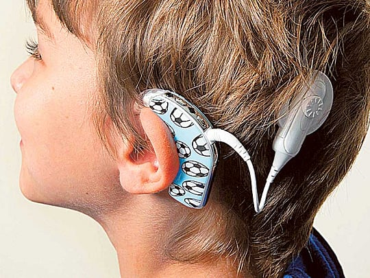 Cochlear Implant Unit opens at University Hospital Sharjah