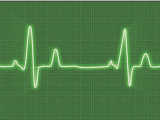 Heartbeat can be used to keep your record safe