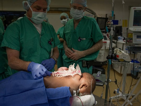 Baby born with extra legs thriving after surgery