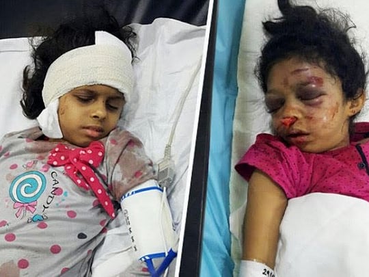 Helper jailed for smashing girls' faces against wall