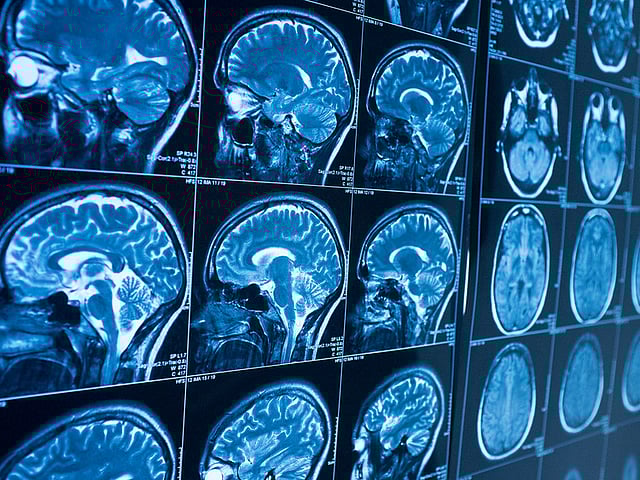 You're not a grown-up yet: How your brain changes at 32