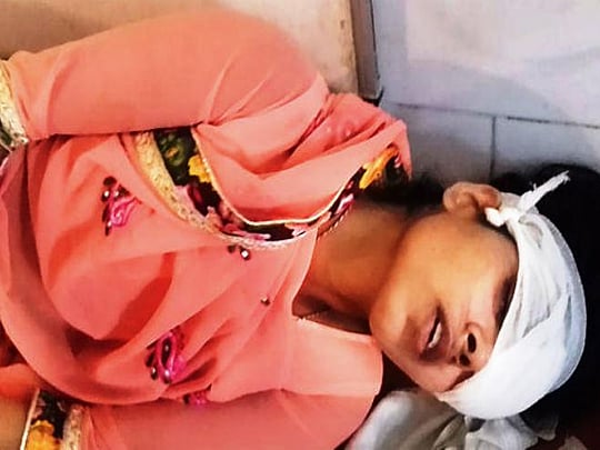 Girl gouges eye out to offer deity