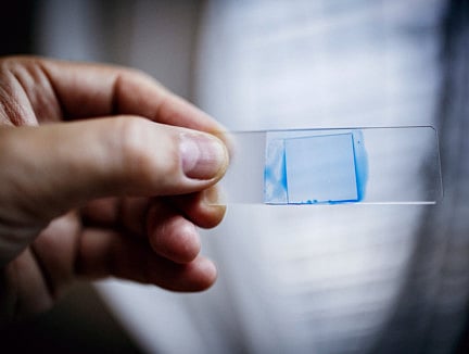 Almost 50% infected by this superbug die in 90 days: CDC