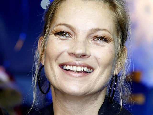 Stars with wonky teeth: Perfectly imperfect
