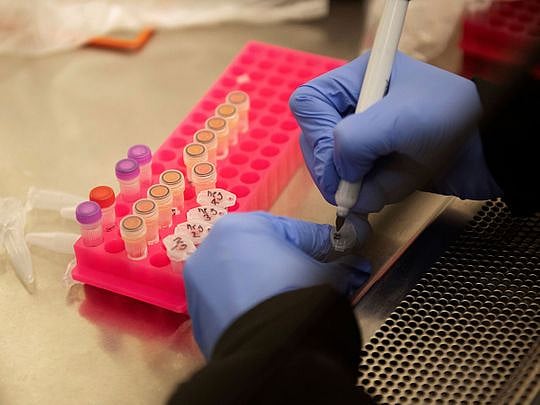 Live COVID-19 found in spit and poop even after recovery