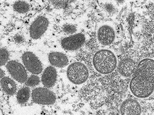 Monkeypox: UAE Health Ministry launches awareness campaign on Twitter