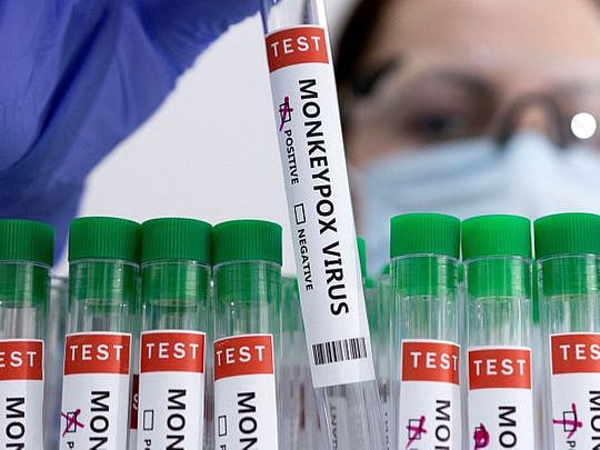 Monkeypox in UAE: Ministry of Health reports 3 new cases in the country