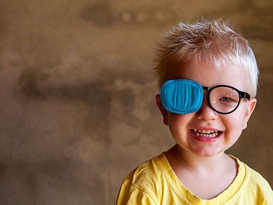 UAE parents: Is surgery the only way to fix a squint in a child?