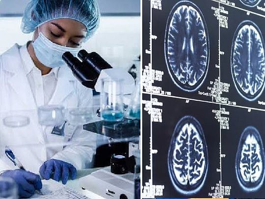 Drug slows Alzheimer's, but can it make a real difference?