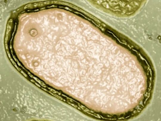 Zombie virus: Can a 50,000-year-old pathogen plague us today?