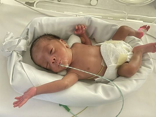UAE: Timely intervention saves premature baby’s vision
