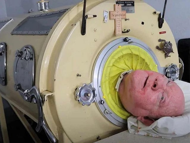 'Man in iron lung' Paul Alexander dies at age of 78