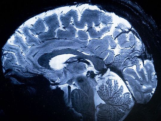 World's most powerful MRI scans first images of human brain