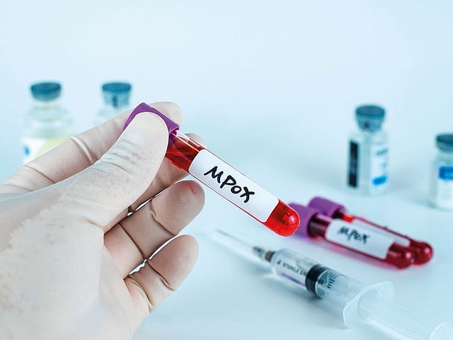 UK health authorities probe unexplained mpox infection