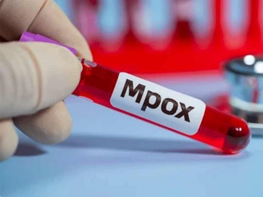 China to screen arrivals for mpox symptoms