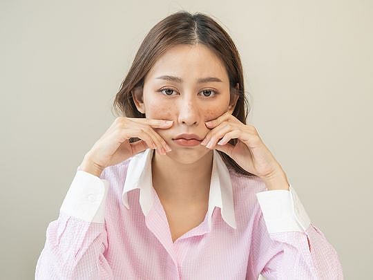 Could stress give you a round face? Unpacking myths, facts behind ...
