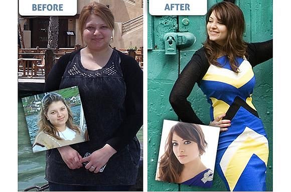 Bulimia Before And After Pictures