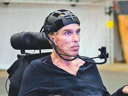 This is Dr Peter, the world’s first cyborg