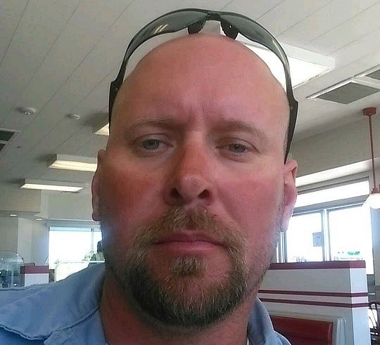 He's Doing Great Year After World's First Eye/Partial Face Transplant