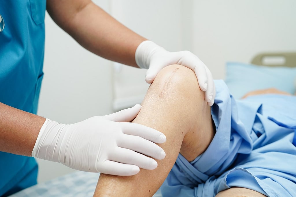Knee Replacement Recovery Time: What You Need To Know