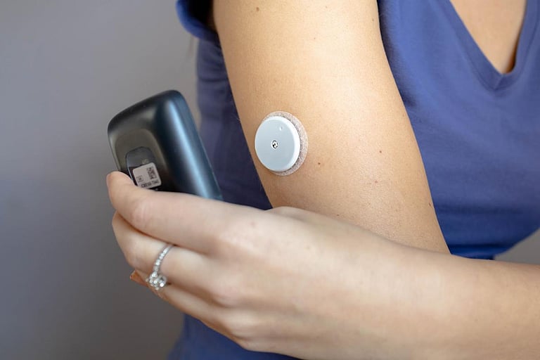 Continuous Glucose Monitoring Improves Blood Glucose Control in T2D