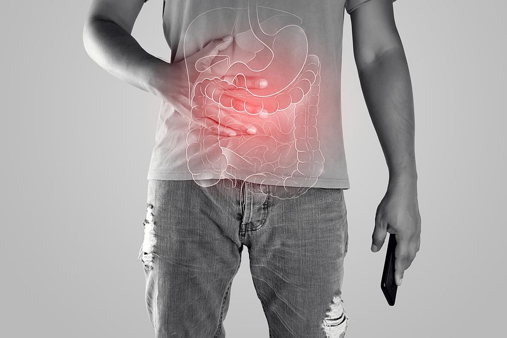 Anti-TL1A Monoclonal Antibody, Tulisokibart, Aids Ulcerative Colitis