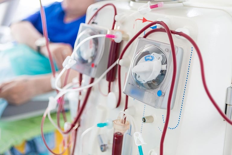 Inpatient Dialysis Initiation Up for CKD Patients With Heart Failure
