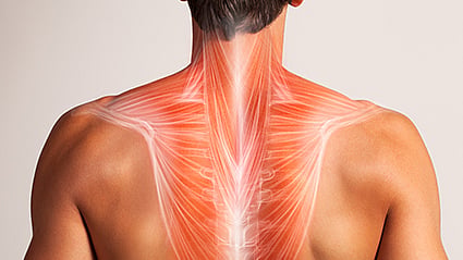 Neck Inflammation May Trigger Headaches and Migraines, Research Shows