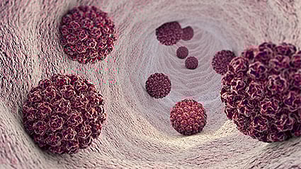 HPV increases risk of heart disease and stroke